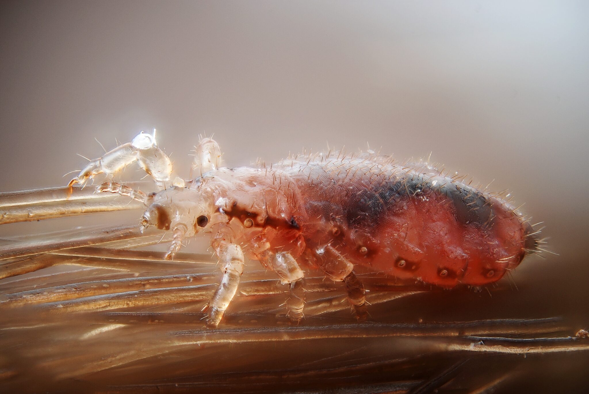 How to Tell If You Have Lice: 5 Clear Signs + Self-Check Guide