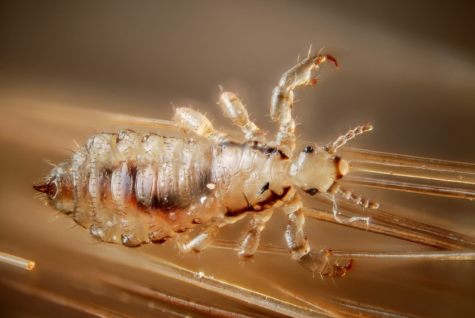 How to Tell If You Have Lice: 5 Clear Signs + Self-Check Guide